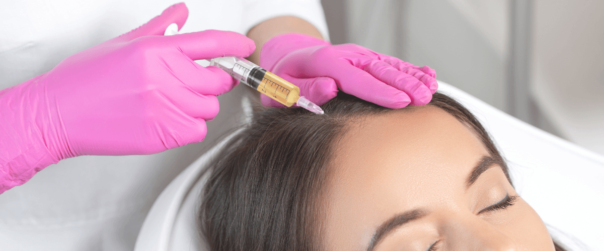 PRP Hair Rejuvenation and Hair Loss Treatment in London | Levitas ...